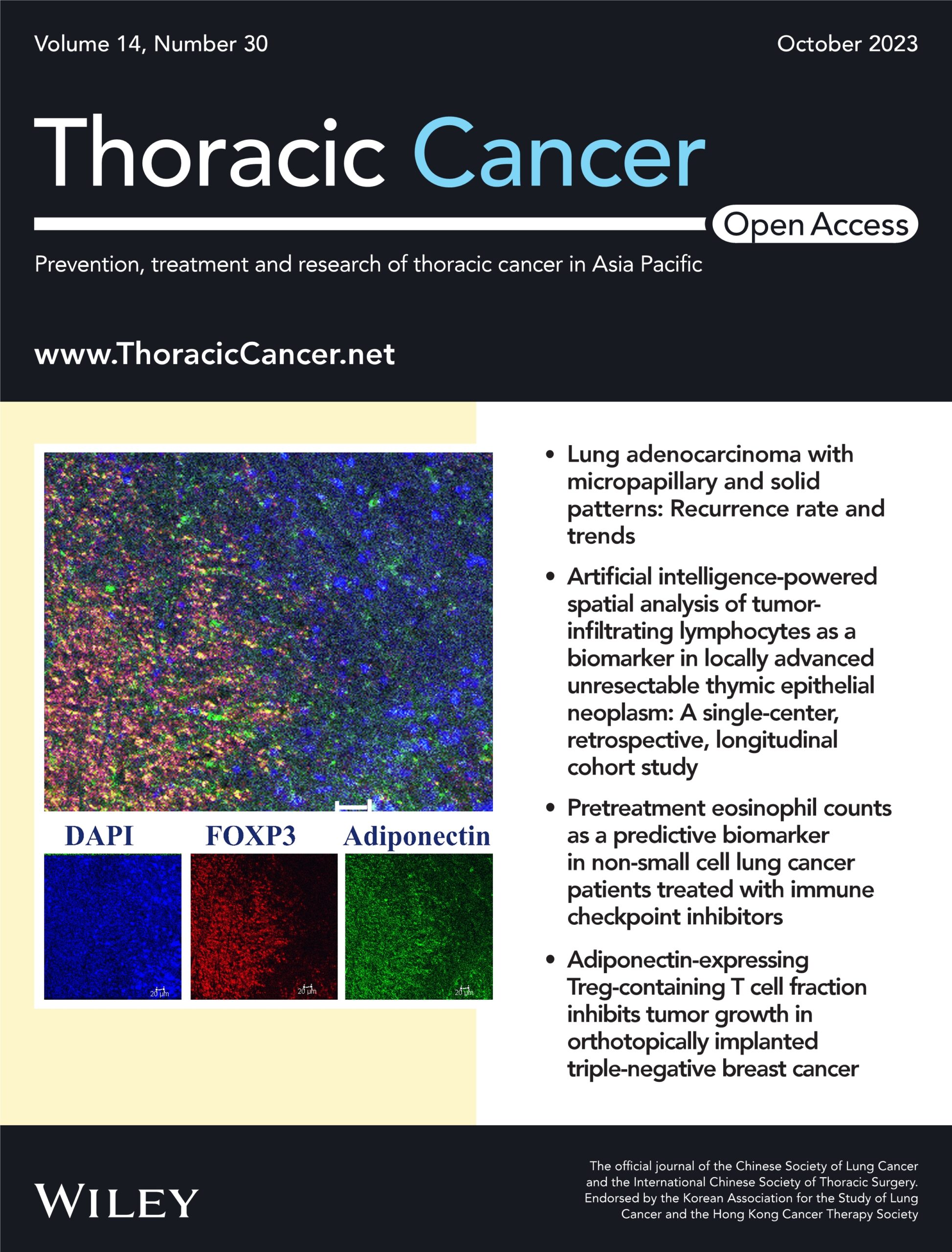 Thoracic cancer10月号のカバーに採択 | 岐阜大学医学部附属病院（消化器外科・乳腺外科）